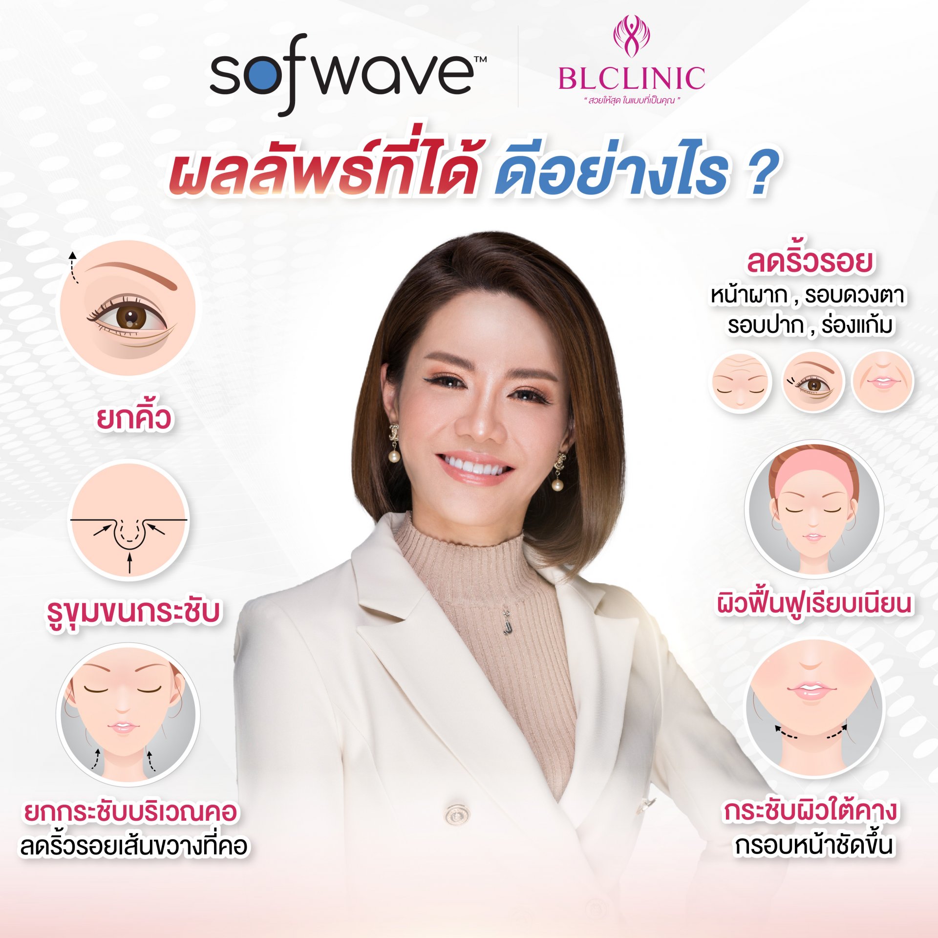 Sofwave เทคโนโลยีด้านการยกกระชับใหม่ล่าสุด