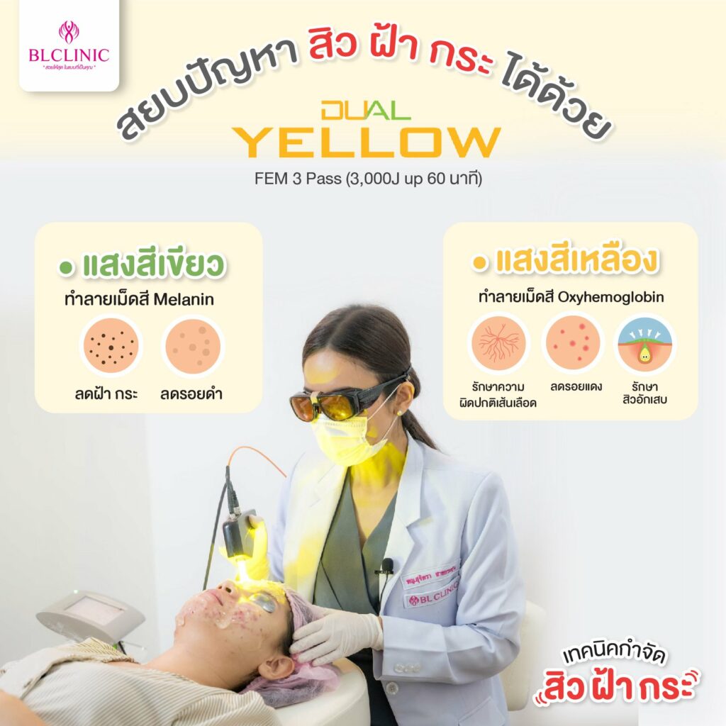 เลเซอร์หน้าใส Dual Yellow Laser แก้ปัญหาผิว สิว รอยแดง แบบจัดเต็ม